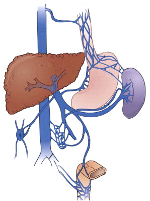 Varizes de Esôfago – Jacob & Paresoto